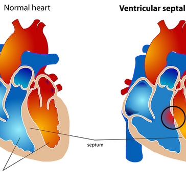 Dr. Alessandro Giardini - Child Heart Specialist